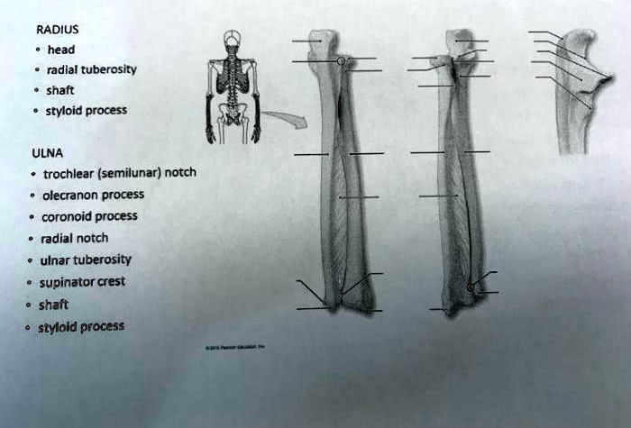 SOLVED: RADIUS head radial tuberosity shaft styloid process ULNA ...