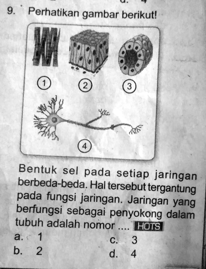 bentuk sel pada setiap jaringanberbeda beda hal tersebut tergantungpada ...