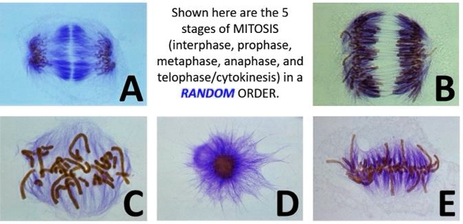 Shown here are the 5 stages of MITOSIS (interphase, prophase, metaphase ...