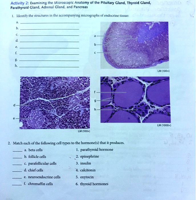 Activity 2: Examining the Microscopic Anatomy of the Pituitary Gland ...