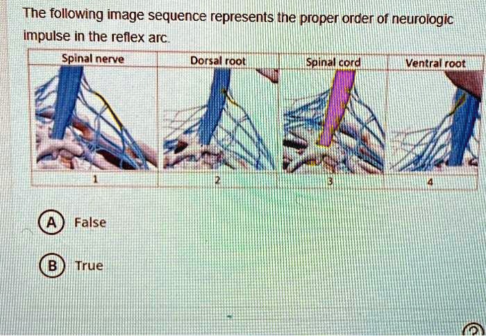SOLVED: The following image sequence represents the proper order of neurologic impulse in the ...