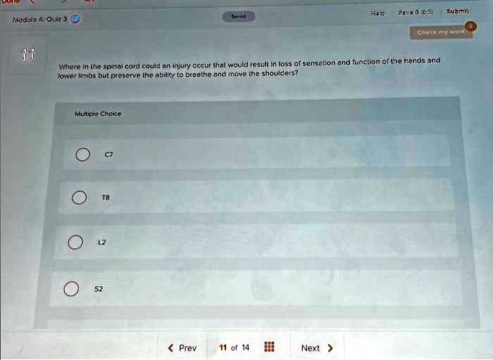 SOLVED: Sevna 10293 bme 3 wmere in the Spinal cord coufd an injury ...