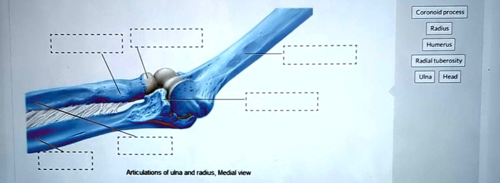 Articulations of ulna and radius, Medial view Coronoid process Radius ...