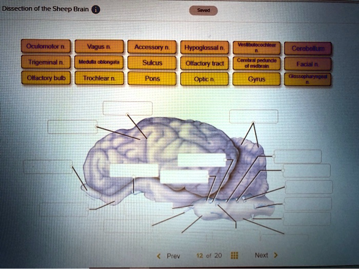 Dissection of the Sheep Brain Oculomotor n. Vagus n. Accessory n ...
