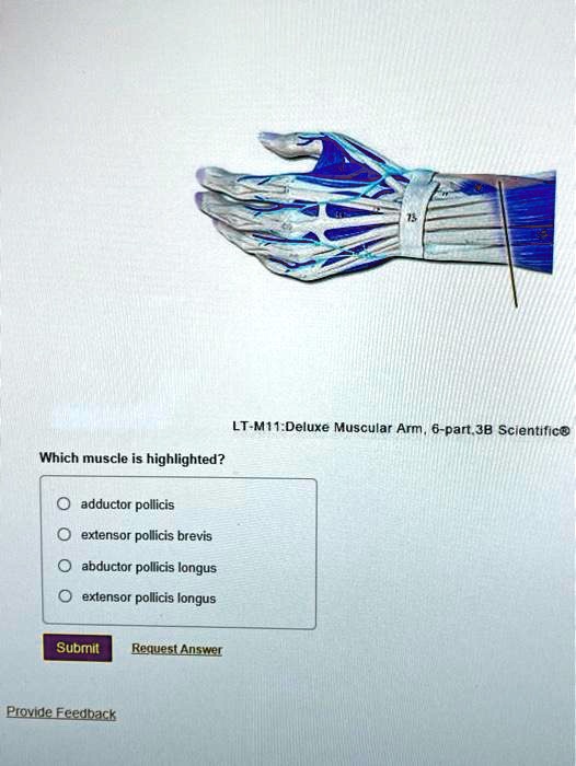 Which muscle is highlighted? LT-M11:Deluxe Muscular Arm, 6-part, 3B ...