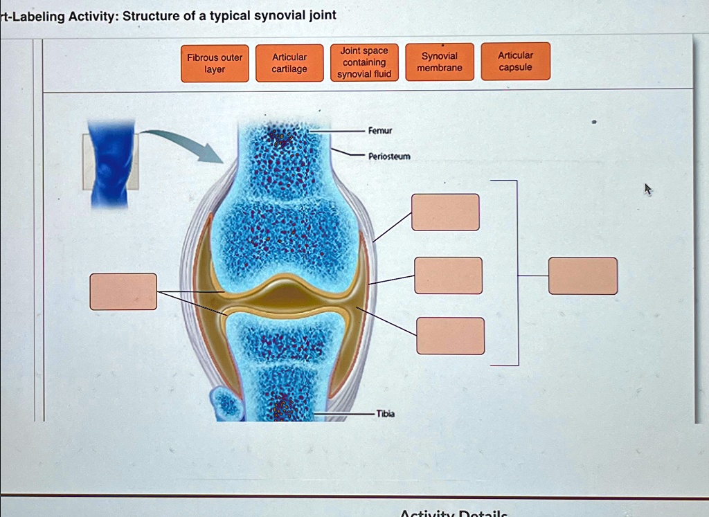 Labeling Activity: Structure of a typical synovial joint Fibrous outer layer Articular cartilage ...