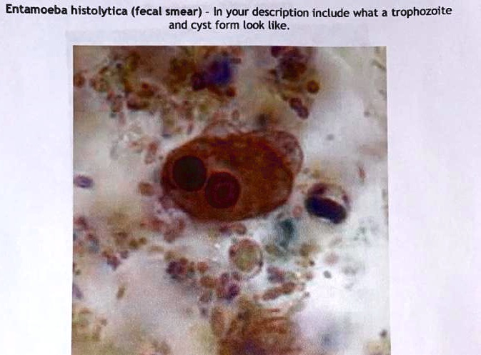Entamoeba histolytica (fecal smear) In your description include what a ...