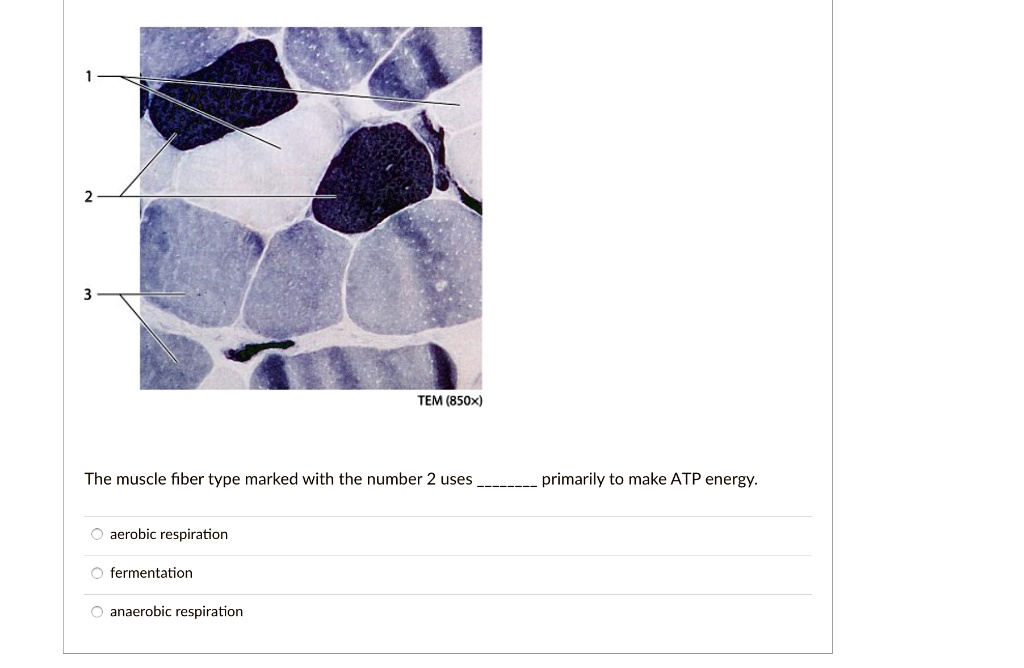 SOLVED: TEM (850x) The muscle fiber type marked with the number 2 uses ...