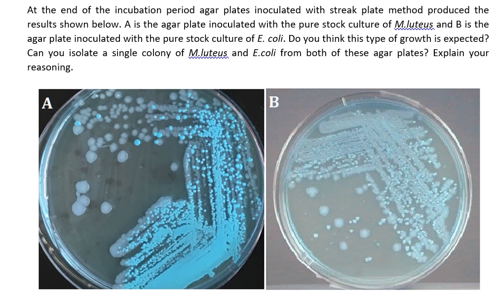 SOLVED: At the end of the incubation period, agar plates inoculated ...
