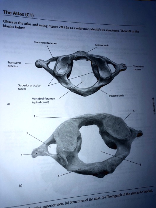 The Atlas (C1) Observe the atlas and using Figure 7B.12a as a reference ...