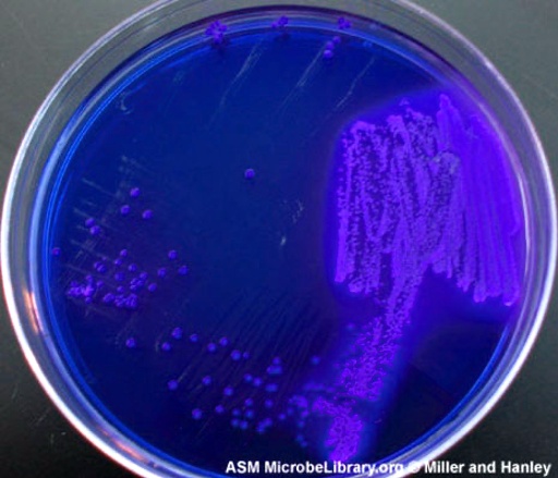 SOLVED: MacConkey Agar 1. Which group of bacteria does MacConkey agar ...