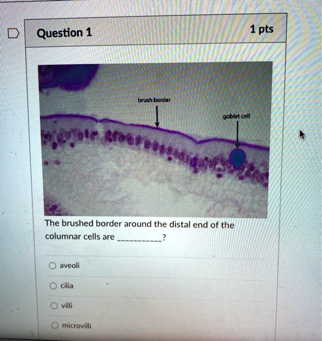 question 1 1 pts lxuthbordet goblet cell the brushed border around the ...