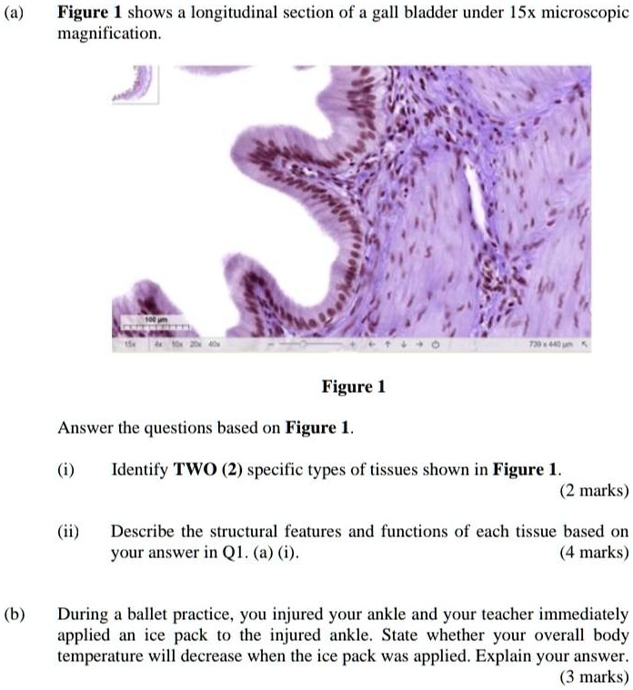 SOLVED: (a) Figure 1 shows a longitudinal section of a gall bladder ...