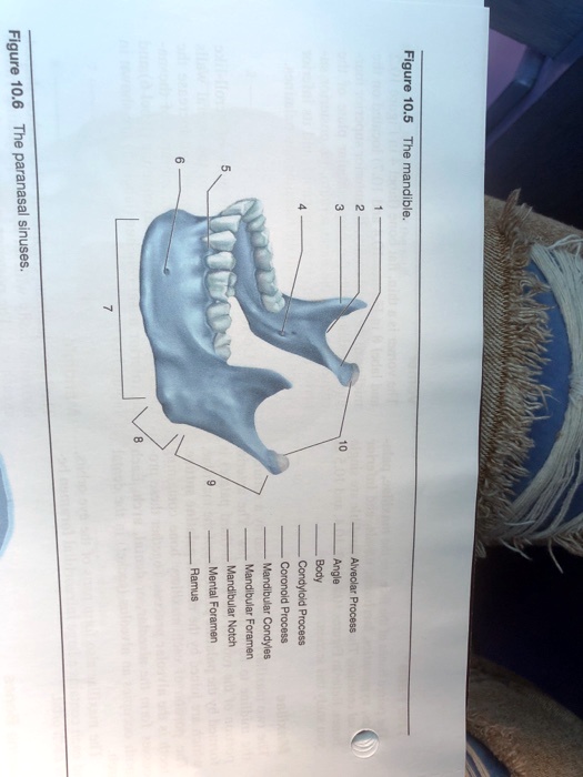 SOLVED: Figure 10.6: The paranasal sinuses. Figure 10.5: The mandible ...