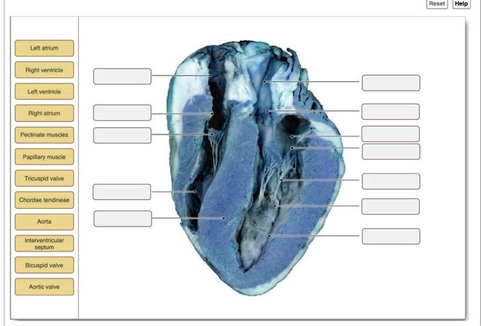 SOLVED: Reset Help Left atrium Right ventricle Left ventricle Right ...