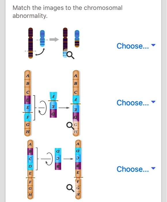 SOLVED: Match the images to the chromosomal abnormality: Choose ...