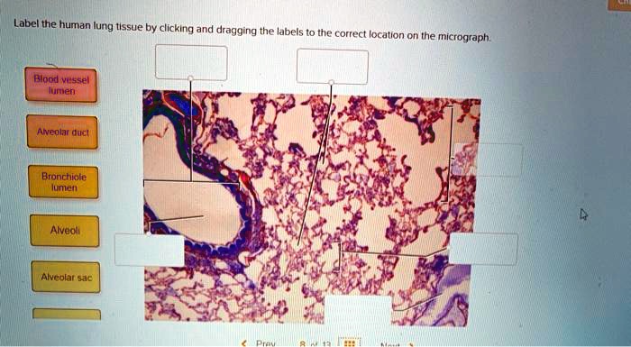 label the human lung tissue by clicking and dragging the labels the ...
