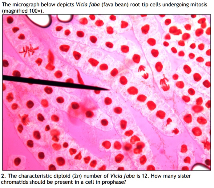 SOLVED: The micrograph below depicts Vicia faba (fava bean) root tip ...