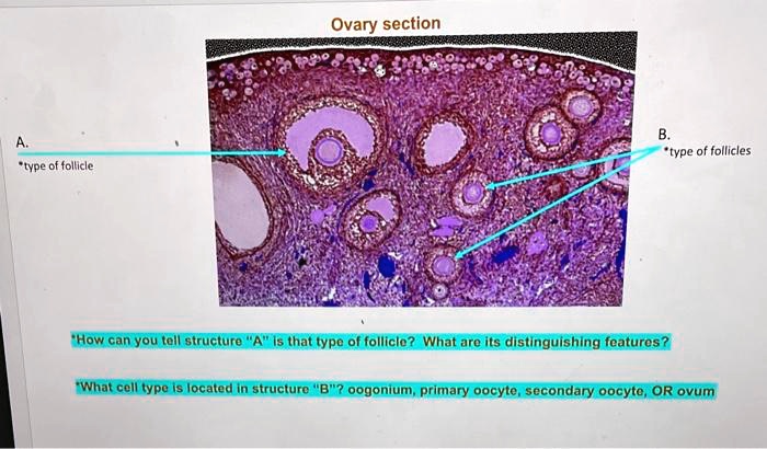 Ovary section A. B. "Type of follicles *Type of follicle How can you ...