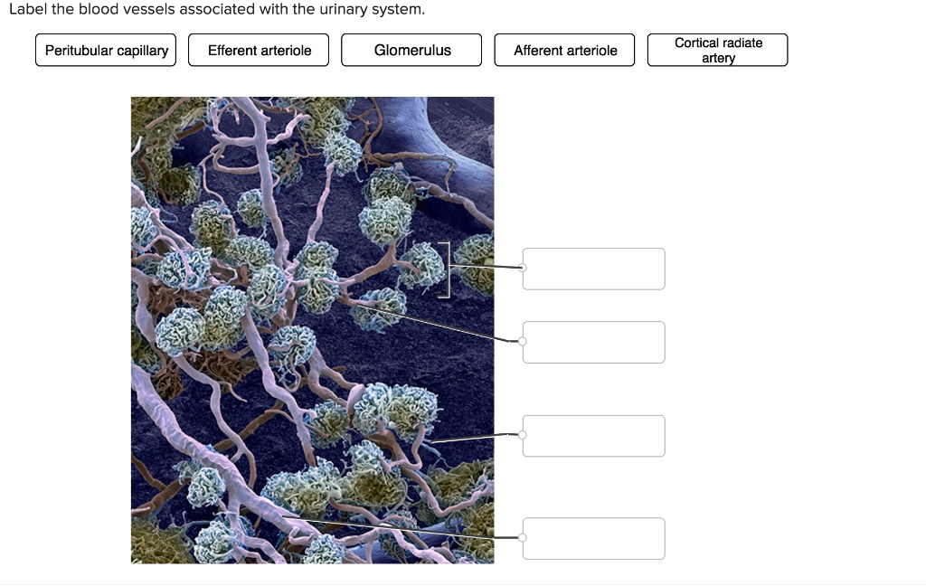 SOLVED: Label the blood vessels associated with the urinary system ...