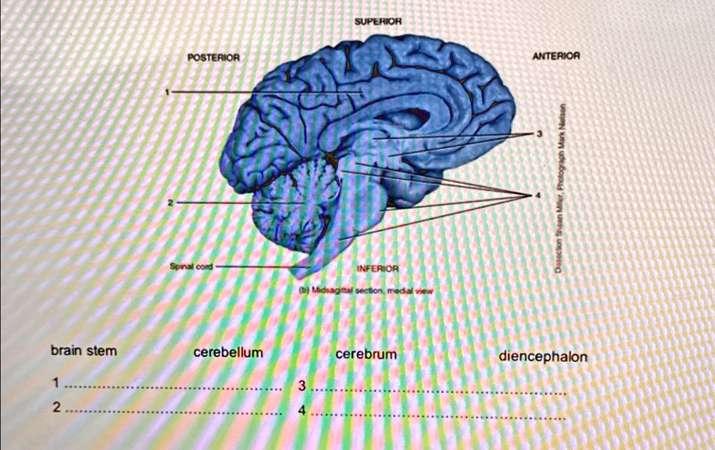 (D) Mid-sagittal section, medial view brain stem cerebellum cerebrum ...