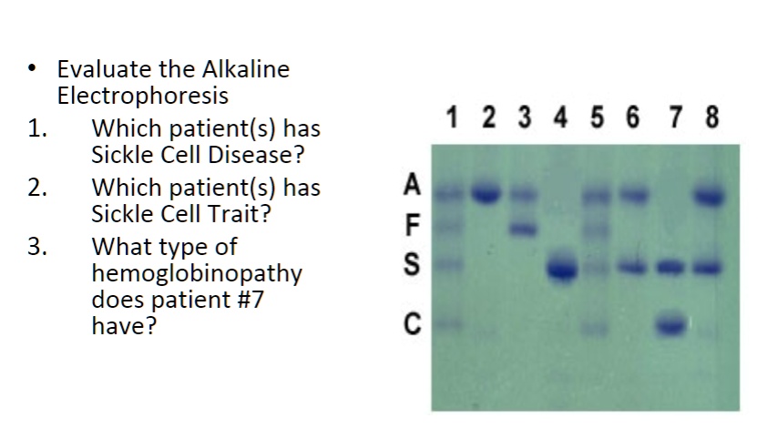 SOLVED: Evaluate the Alkaline Electrophoresis 1. Which patient(s) has ...