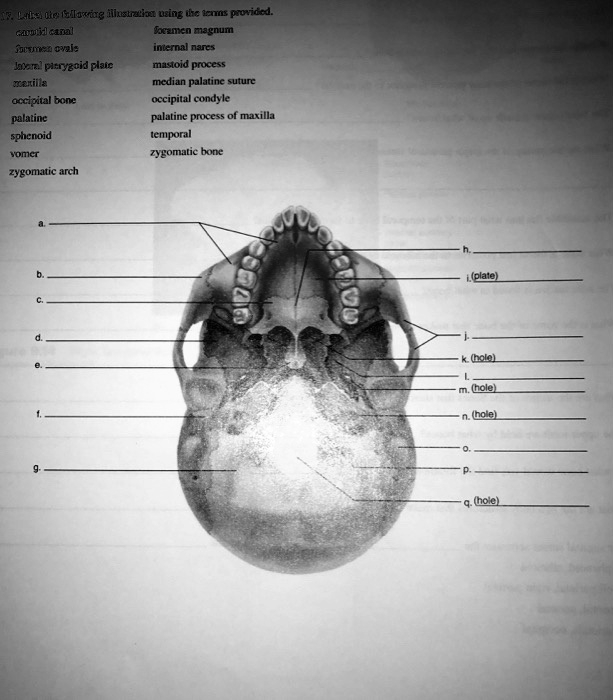 Solved Label The Axial Skeleton Skull Logging The Terms Provided