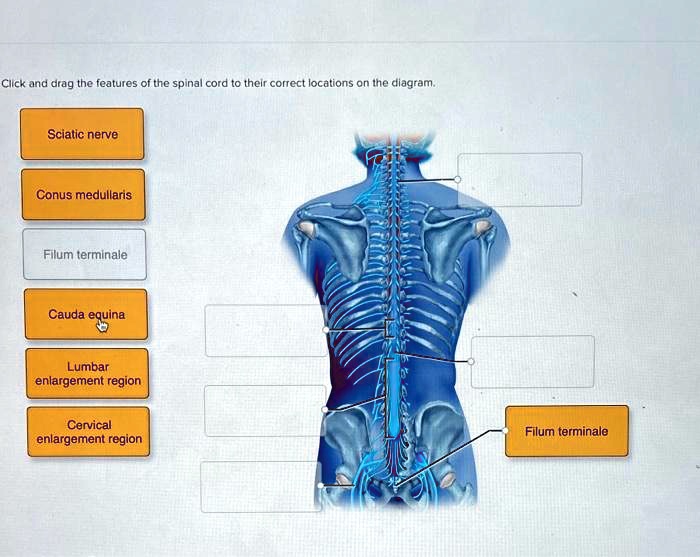 Conus Medullaris Filum Terminale Exposed Spinal Canal