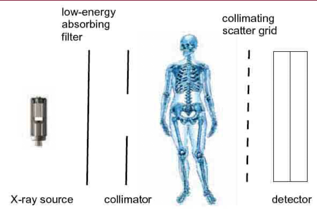 SOLVED: Assuming an X-ray tube emitting X-rays from a point source as shown in the figure below ...