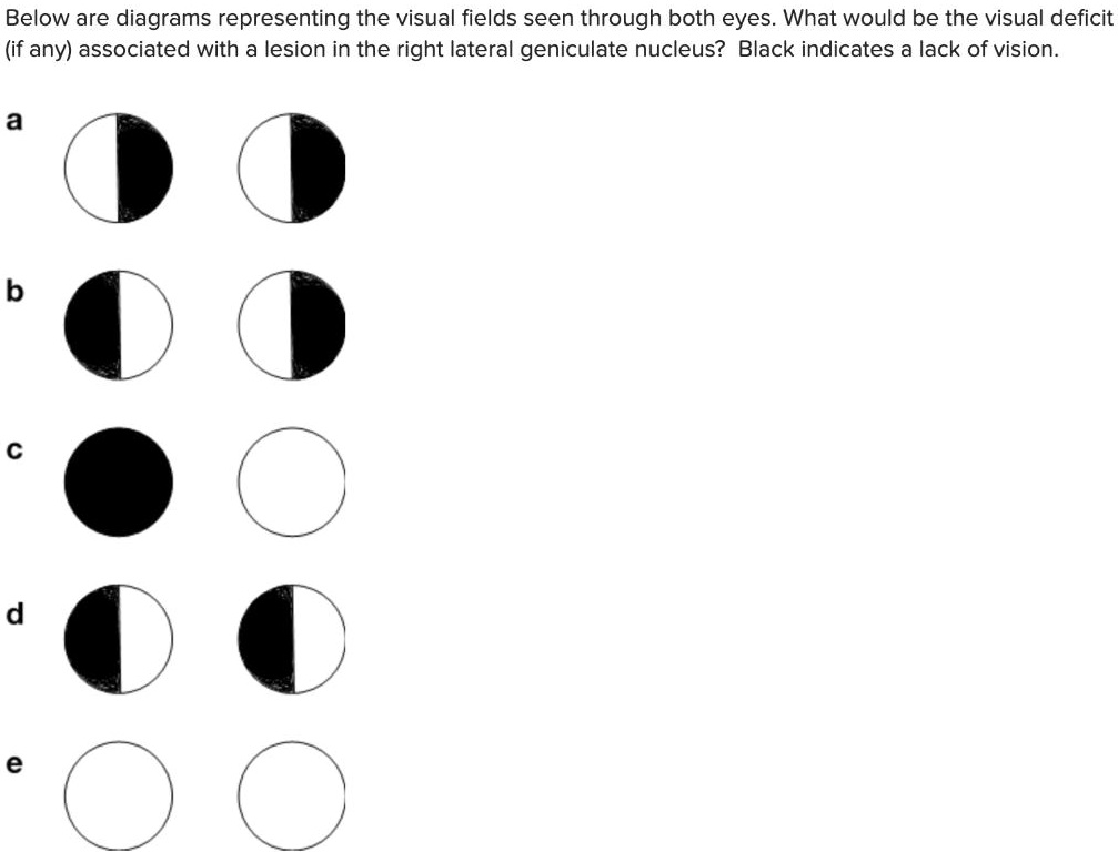 Below are diagrams representing the visual fields seen through both ...