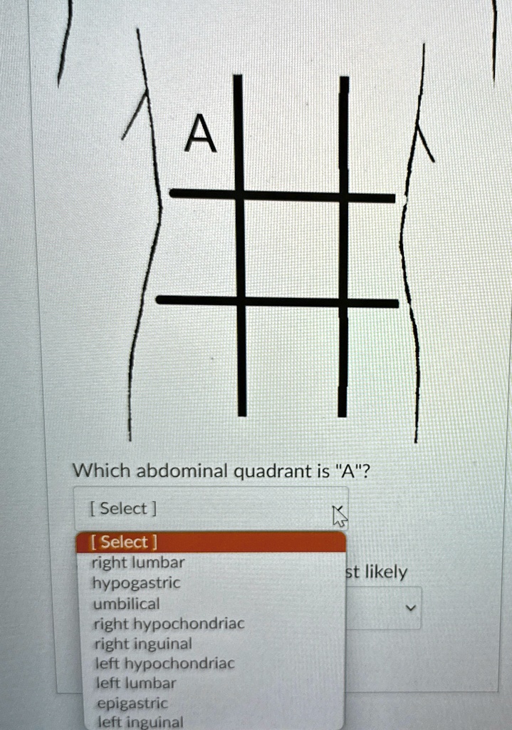 A Which abdominal quadrant is "A"? [Select] [Select] right lumbar ...