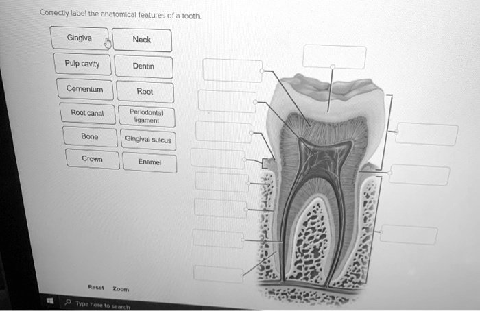 Gingiva Neck Pulp cavity Dentin Cementum Root Root canal Periodontal ...
