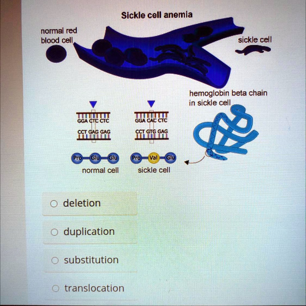 SOLVED: 'select the correct answer sickle cells disease is a here ...