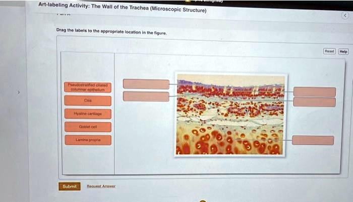 Art-labeling Activity:The Wall of the Trachea (Microscopic Structure ...