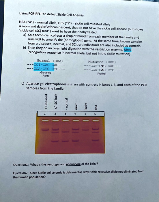 using pcr rflp to detect sickle cell anemia hba a norm allele hbs s sickle cell mutated allele ...