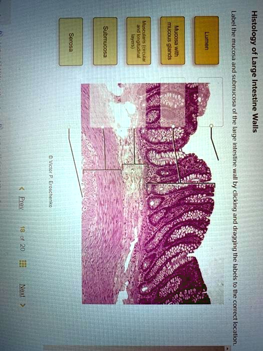 Histology of Large Intestine Walls Label the mucosa and submucosa of ...