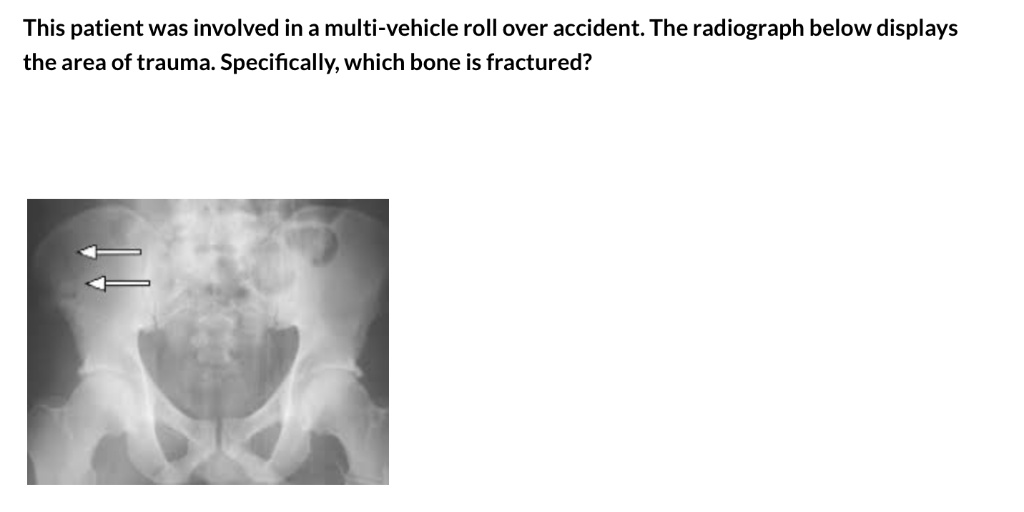 SOLVED: This patient was involved in a multi-vehicle rollover accident ...