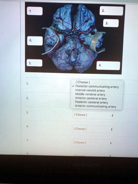 SOLVED: label 1-6. those are the answer choices [Choose] VPosterior ...