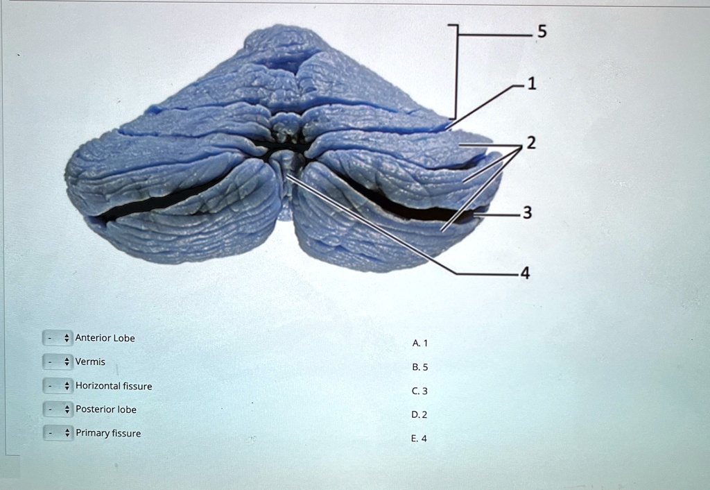 anterior lobe vermis horizontal fissure posterior lobe primary fissure a 1 b 5 c 3 d 2 e 4 1 2 3 ...