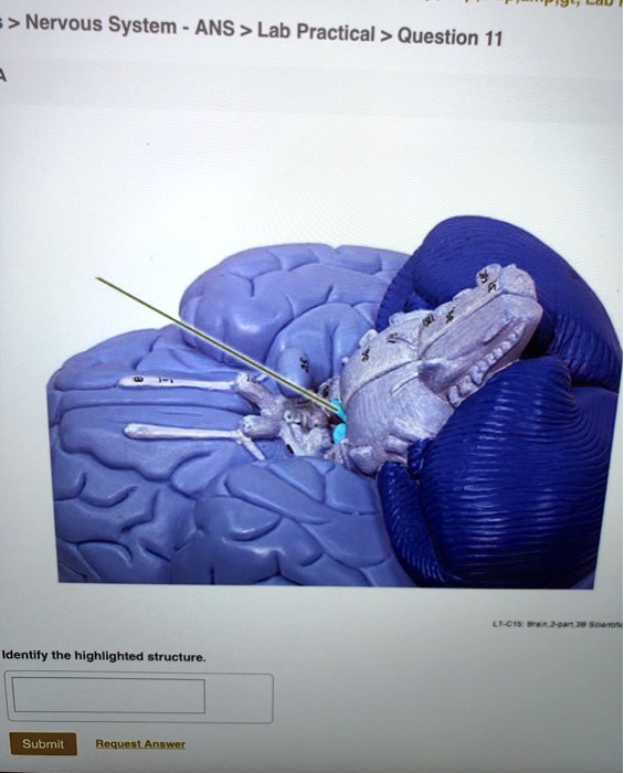 SOLVED: >Nervous System-ANS>Lab Practical>Question 11 Identify the ...