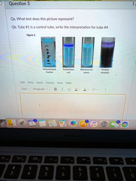 SOLVED: Question 3 Qa. What test does this picture represent? Qb. Tube ...