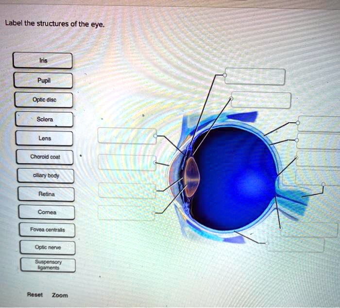 SOLVED: Text: Label the structures of the eye Iris Pupil Optic disc ...
