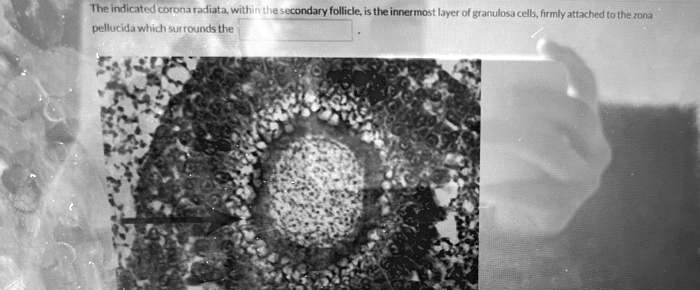 The indicated corona radiata, within the secondary follicle, is the ...