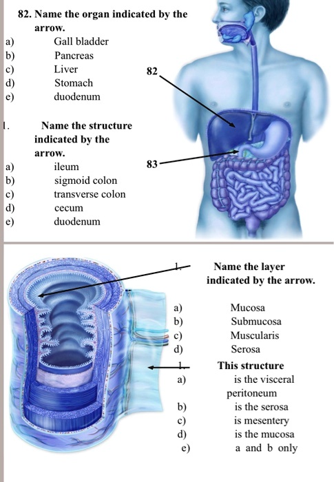 SOLVED: 82. Name the organ indicated by the arrow: Gall bladder ...