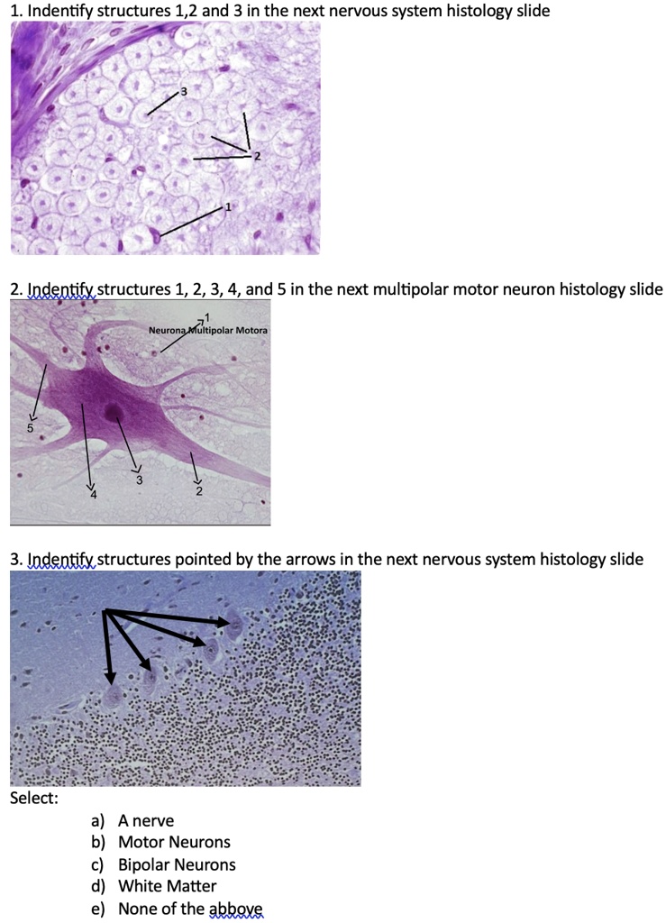 1. Identify structures 1, 2, and 3 in the next nervous system histology slide. 2. Identify ...