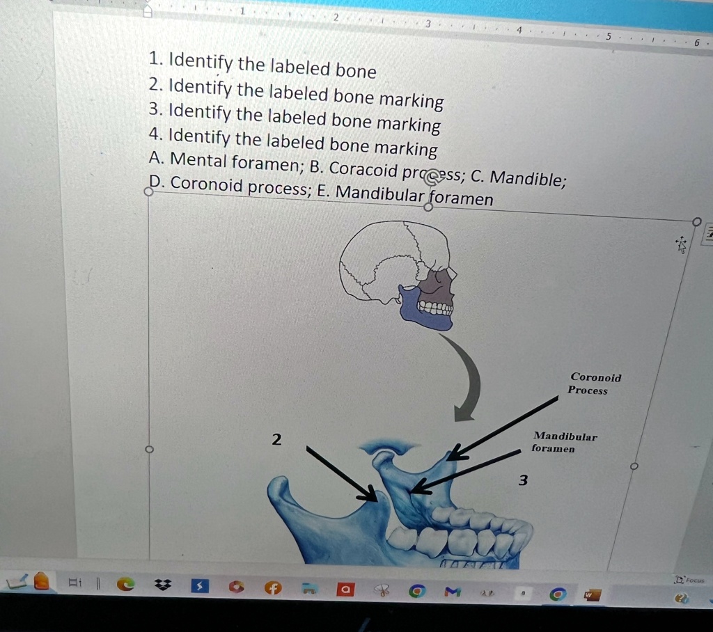 1. Identify the labeled bone 2. Identify the labeled bone marking 3. Identify the labeled bone ...