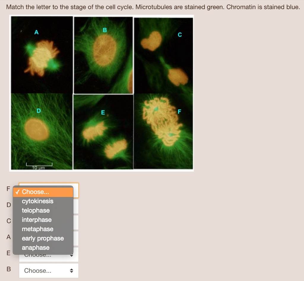 SOLVED: Match the letter to the stage of the cell cycle. Microtubules ...