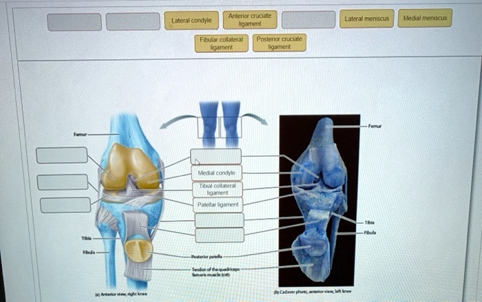 Femur Tibia Fibula )Anterior view, right knee Lateral condyle Anterior ...
