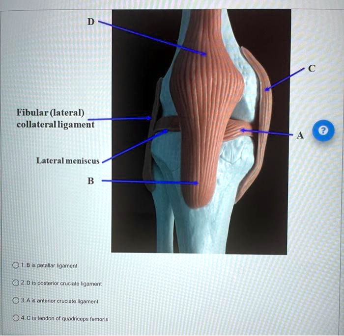 D Fibular (lateral) collateral ligament Lateral meniscus B 1.B is ...