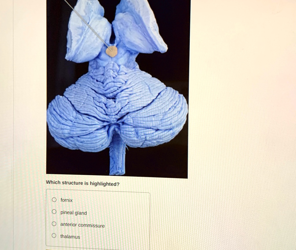 which structure is highlighted fornix pineal gland anterior commissure ...